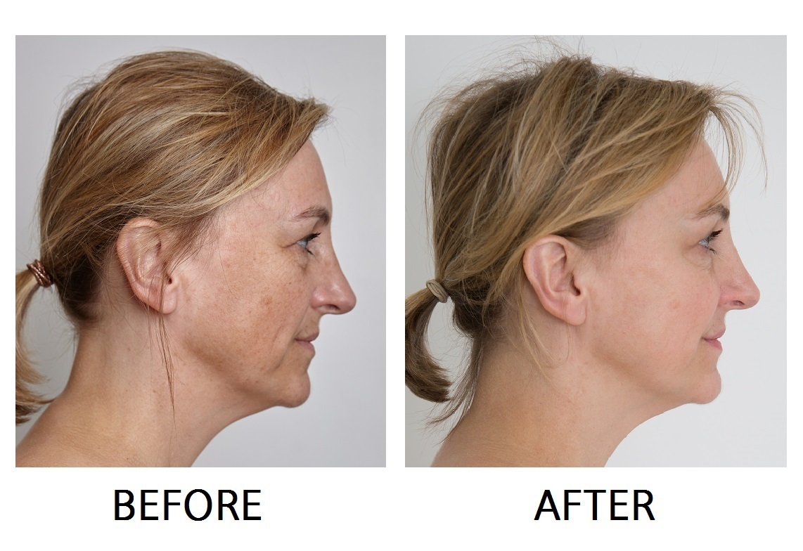 The Ultimate Make-Over Package