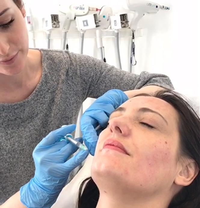 Volite HA Boost | EF MEDISPA